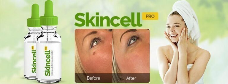Skincell Pro Remove Moles From Face - BEST HEALTHY SOLUTION FOR YOU
